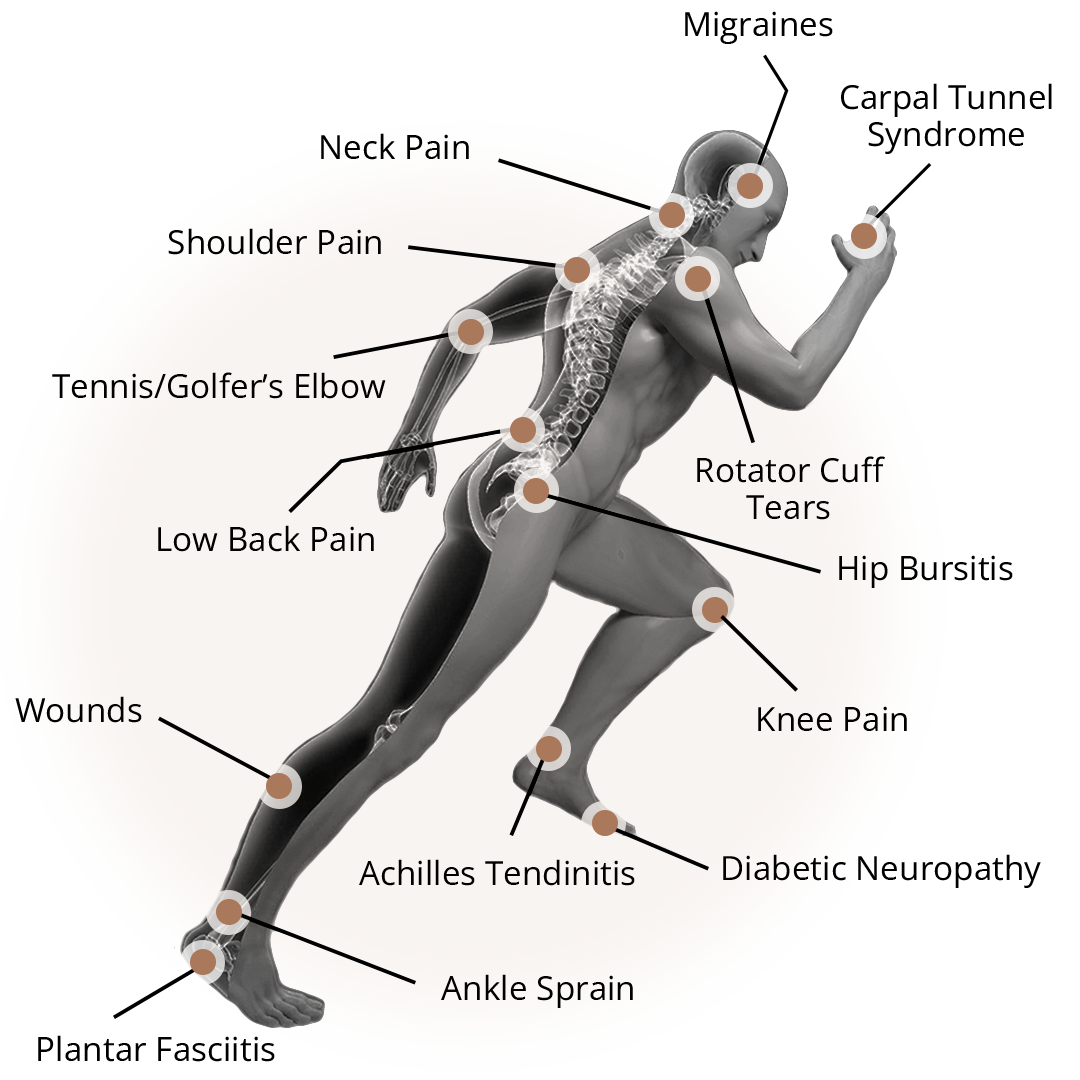 Vancouver BC Laser Therapy Dr Sereena Uppal Vancouver BC Laser Therapy Dr Sereena Uppal